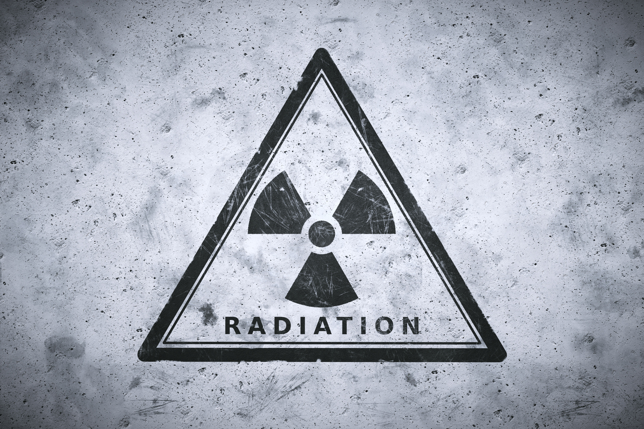 FAQs: Advantages of using small controlled area radiography (SCAR) in ...